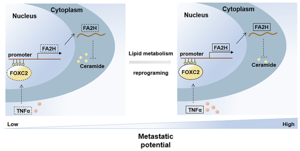 STTT︱刘芝华/吴楠团队揭示脂质代谢在癌症转移过程中的重要机制 - 知乎