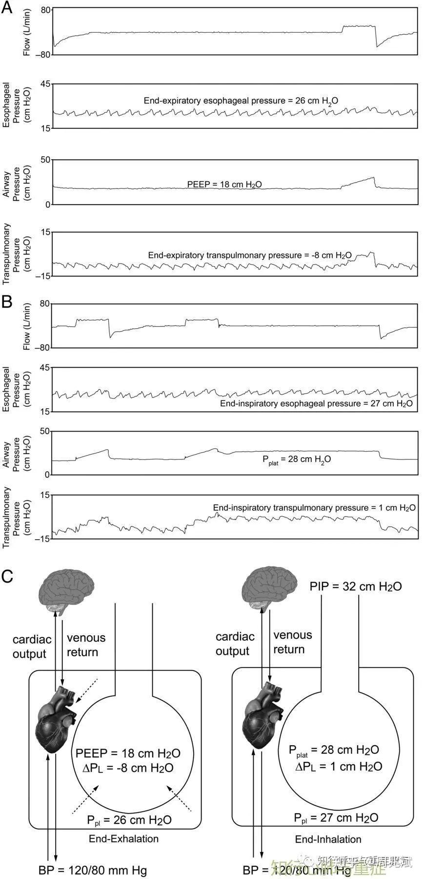 第142期 呼吸力学-从基础到临床 - 知乎