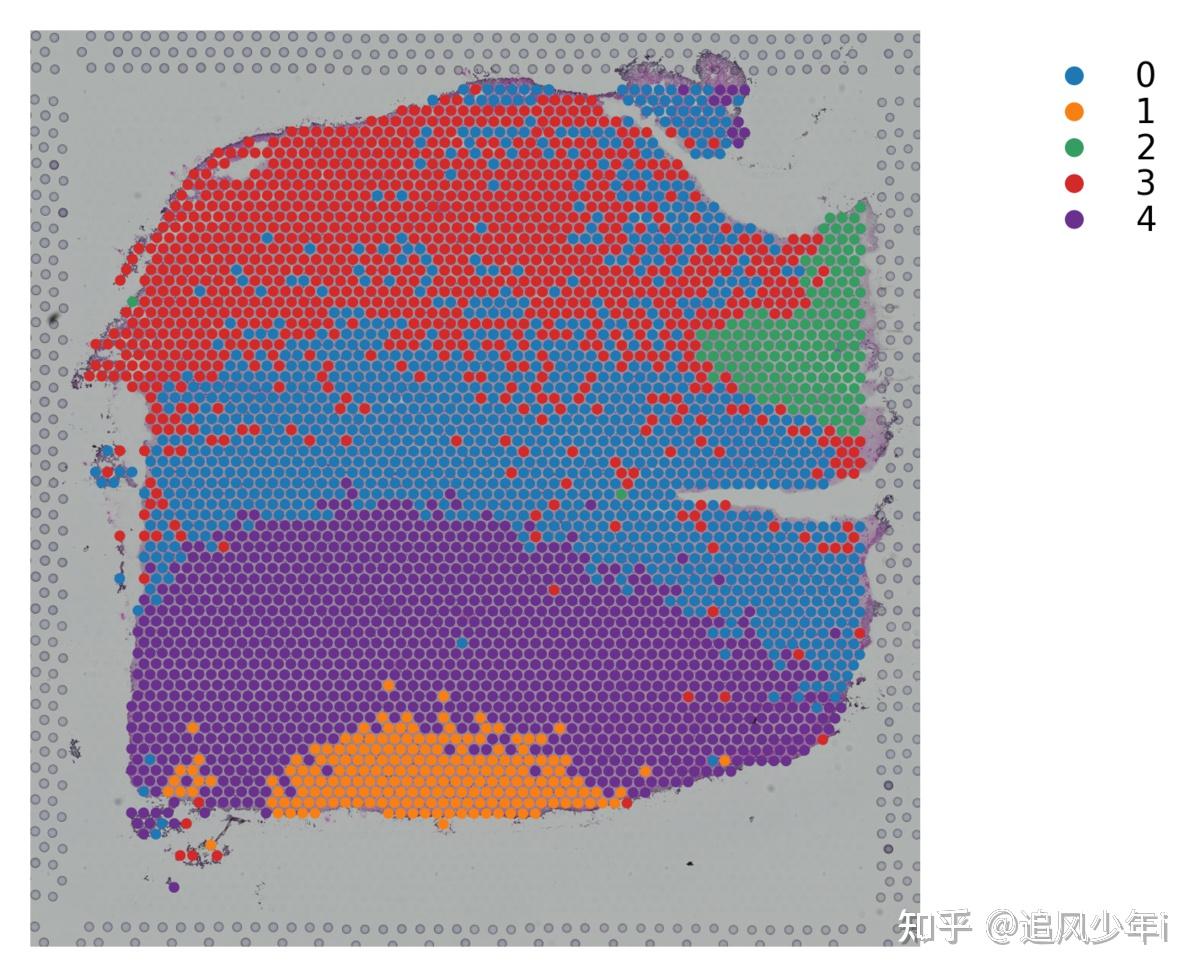 10X单细胞空间回顾之stlearn - 知乎