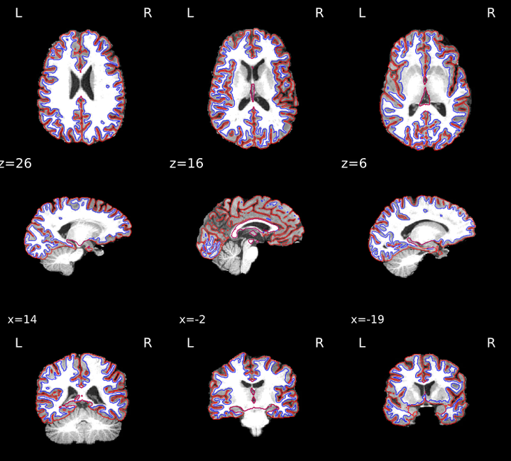拥抱潮流，基于BIDS格式的磁共振数据分析系列：1，磁共振数据分析工具简介篇 - 知乎
