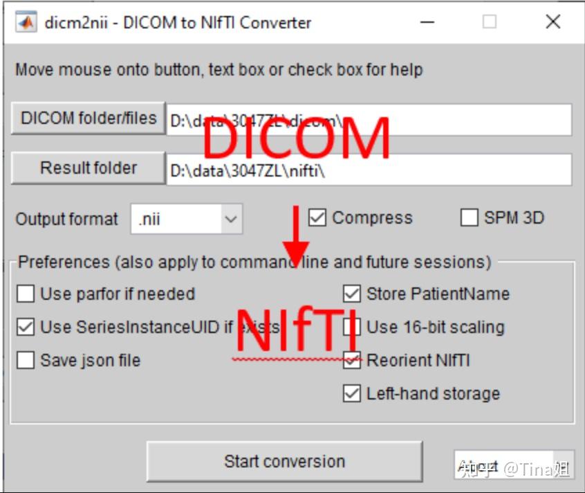 【最全】如何不写代码将 Dicom 图像转 Nifti 格式， 7种工具任你选！ - 知乎