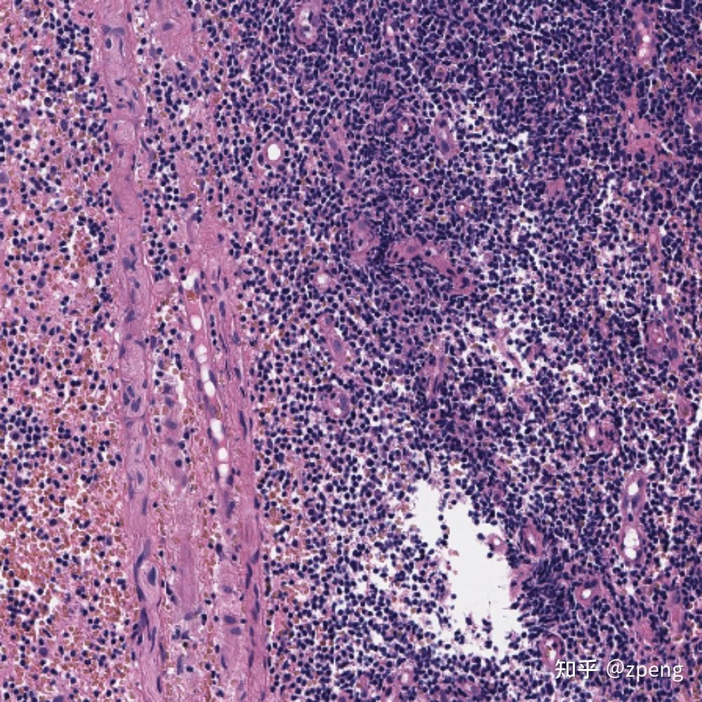 模型方法-语义分割GroupVit - 知乎