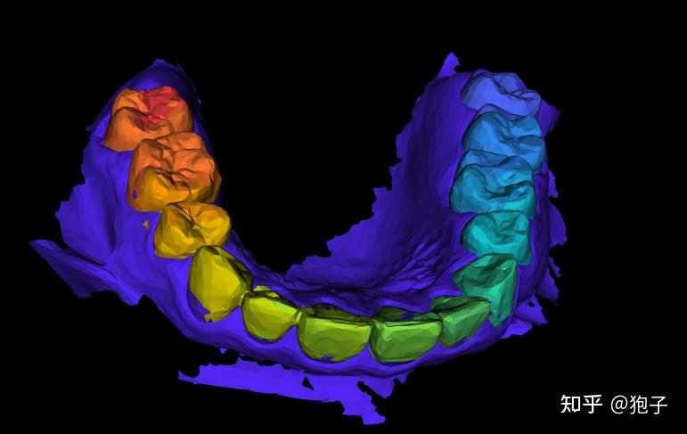 MeshSegNet（2） - 知乎