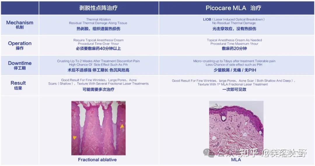 Picoway、picosure、picocare这三种常见的皮秒设备之间有何不同？ - 知乎