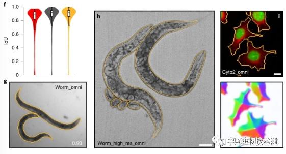Nature子刊：深度学习算法可以在显微镜图像中识别出各种细菌 - 知乎