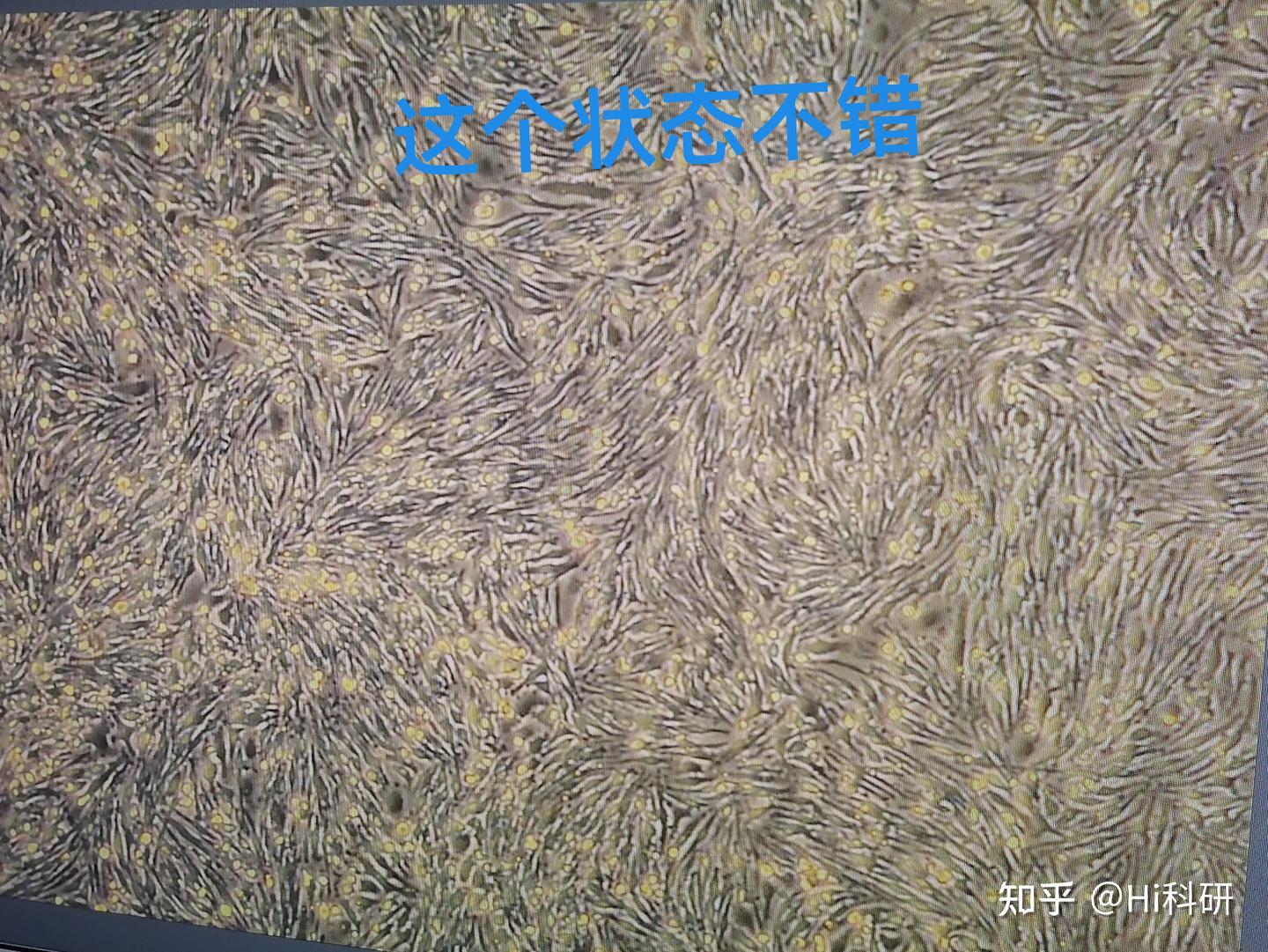 BMDM小鼠骨髓源性原代细胞培养 生物实验 研究生 - 知乎