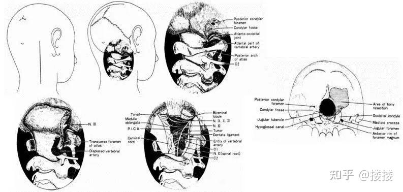 巴特朗菲教授(Helmut Bertalanffy) - 知乎