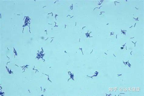 肠道核心菌属——优/真杆菌属（Eubacterium），你为什么要关心它？ - 知乎