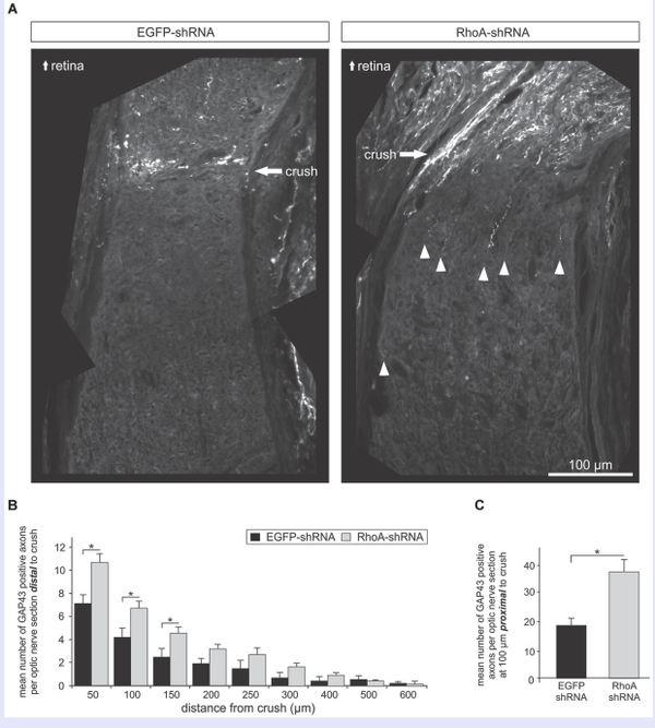 腺相关病毒AAV在眼科中应用研究 - 知乎