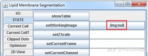 ImageJ实用技巧——3D细胞自动分割(插件篇) - 知乎