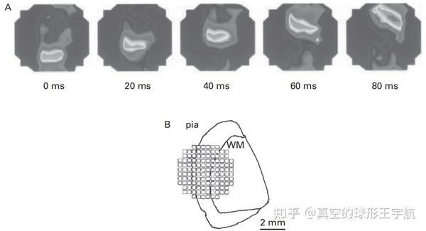 从运动科学到神经科学：Wilson-Cowan模型（附Netloog源码） - 知乎