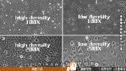 Ishikawa细胞培养，人子宫内膜腺癌细胞培养攻略 - 丰晖生物 - 知乎
