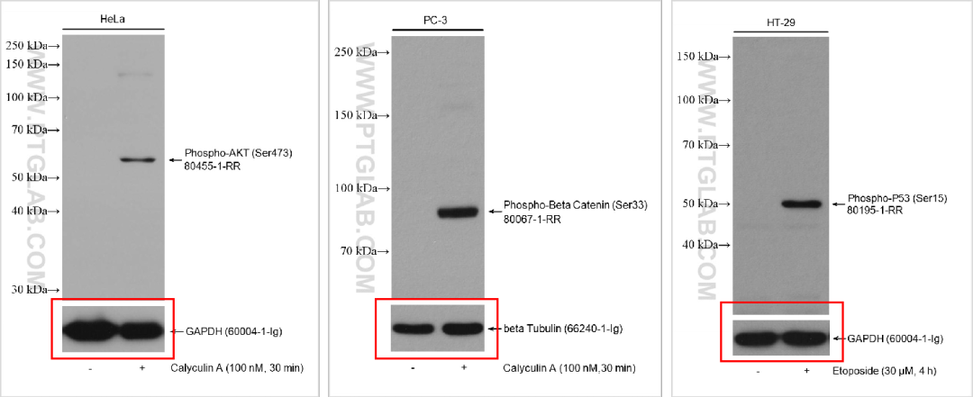 WB内参抗体怎么选？看完这组数据我悟了！ - 知乎