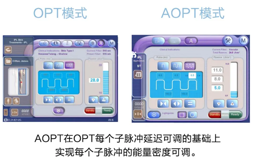 AOPT三个子脉冲的优势？不同适应症怎么设置能量？ - 知乎