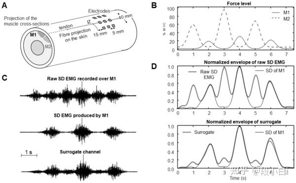高密度表面肌电（HD-sEMG）的临床应用 - 知乎