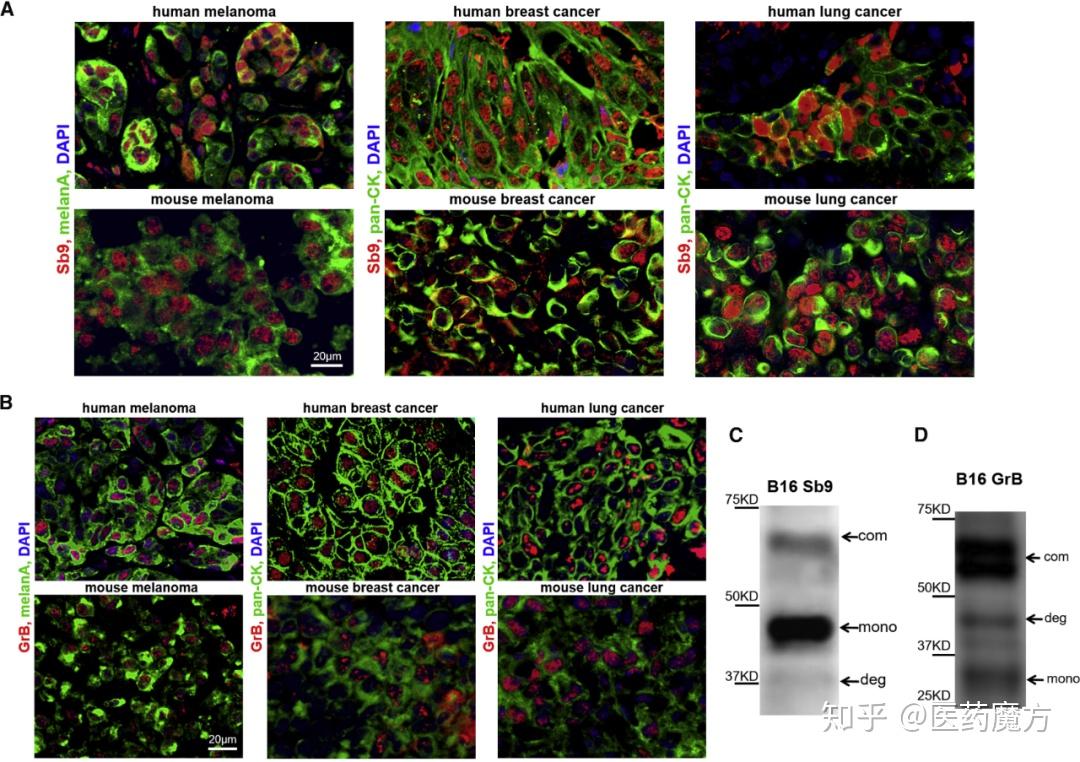 Cell：癌症免疫治疗新靶点——SerpinB9 - 知乎