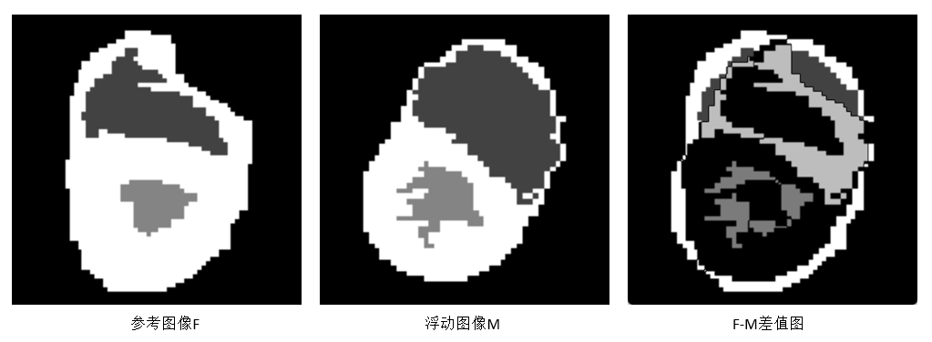 传统配准demons微分同胚demons 知乎