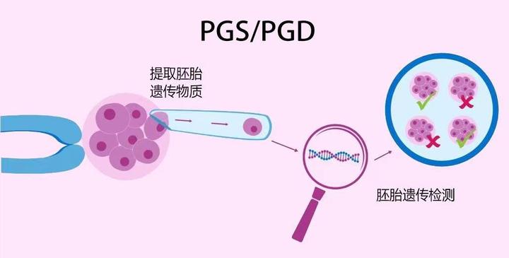 PGS/PGD检测胚胎的原理和作用 - 知乎
