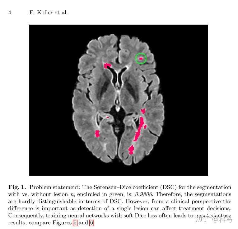 论文笔记 blob loss: instance imbalance aware loss functions for semantic segmentation - 知乎