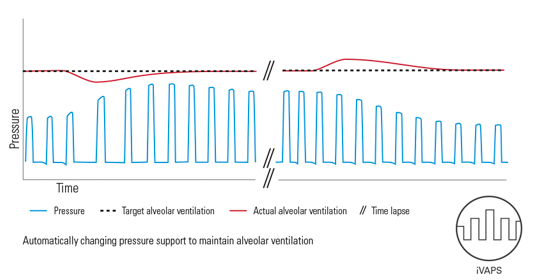家用慢阻肺呼吸机ST、AVAPS和iVApS 之间有啥区别？ - 知乎