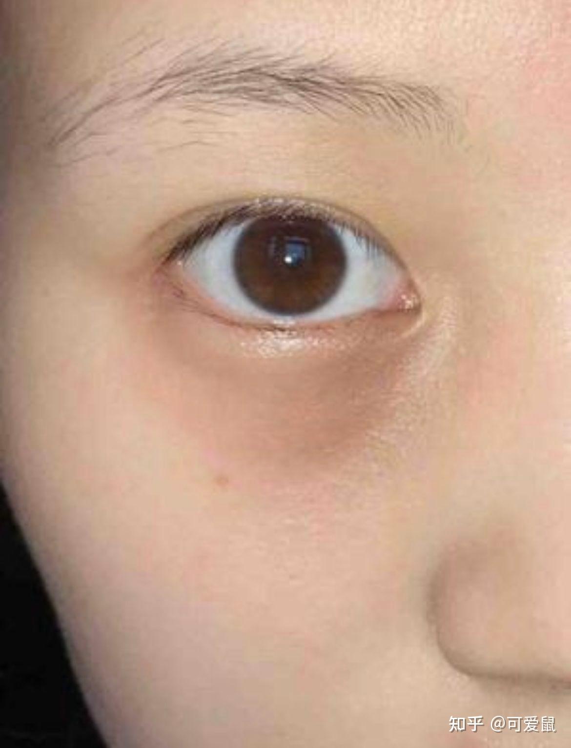 每天盯着电脑10小时以上的人,怎么继续保护眼睛? 知乎