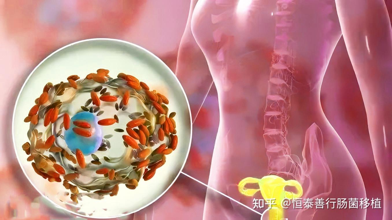 戴阿利斯特杆菌属（Dialister） - 知乎