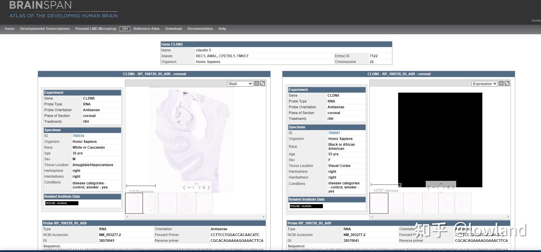 关于Allen brain atlas ISH图像? - 知乎