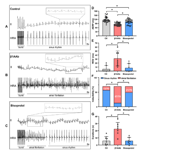 在主动免疫兔模型中，增高的β1肾上腺素能受体自身抗体通过介导心房钙处理异常和纤维化构建房颤的易损基质 - 知乎