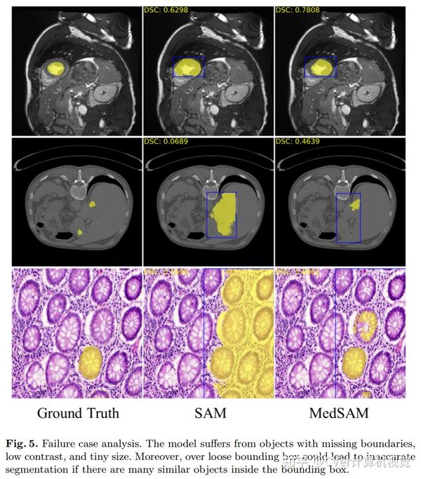MedSAM：分割医学图像中的一切 - 知乎