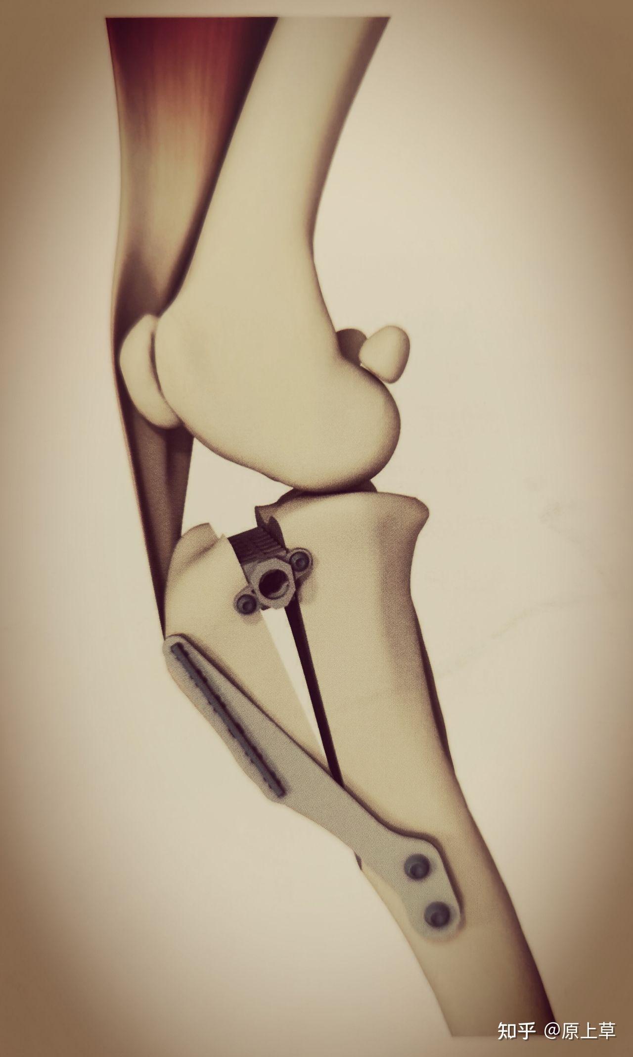 犬十字韧带断裂 - 知乎