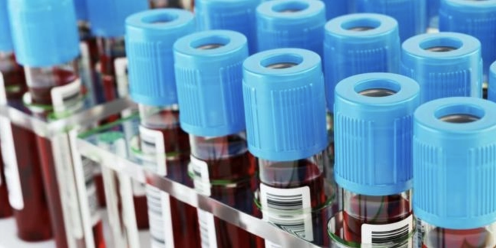 EM-seq 技术疾病分子标志物新发现：cfDNA 低甲基化有利冠脉侧支循环 - 知乎