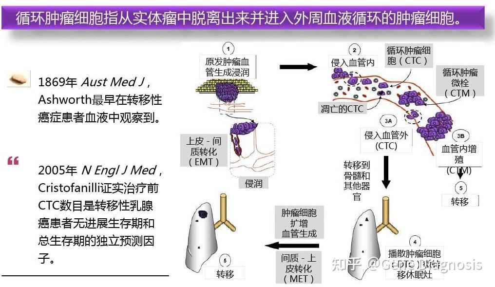 一文读懂循环肿瘤细胞（CTC） - 知乎
