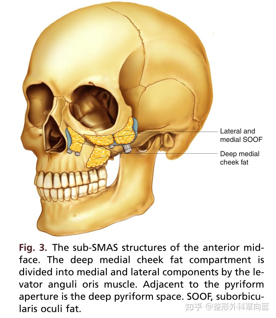 基于SMAS韧带的注射指导，即所谓的“True Lift”注射技术 - 知乎