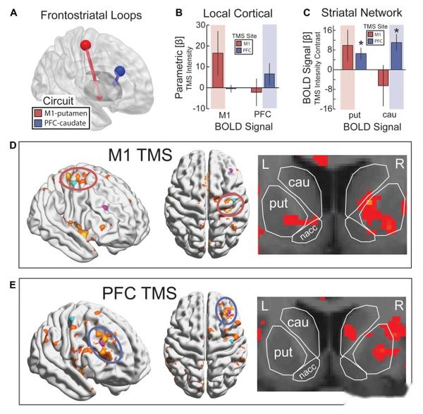 同步TMS-fMRI研究脑功能网络的指南 - 知乎