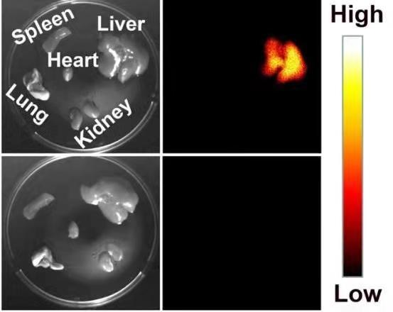 恒光讲堂｜NaGdF4纳米探针：用于靶向细菌的NIR-II光声成像 - 知乎