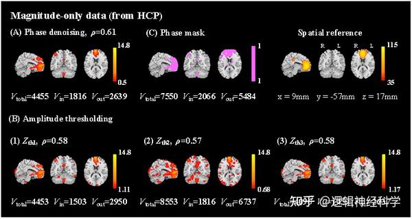 Hum Brain Mapp︱大连理工大学林秋华课题组为fMRI幅值脑网络生成了相位信息并用于统一阈值的高性能消噪 - 知乎