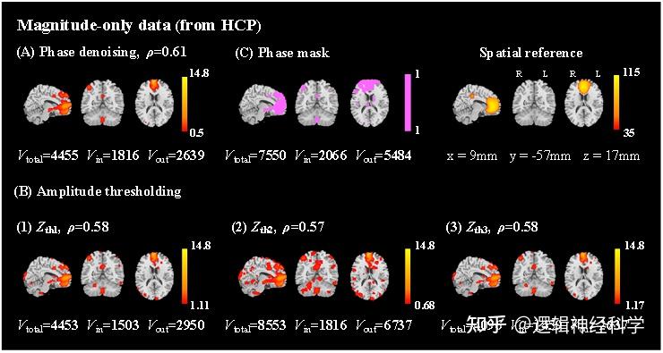 Hum Brain Mapp︱大连理工大学林秋华课题组为fMRI幅值脑网络生成了相位信息并用于统一阈值的高性能消噪 - 知乎