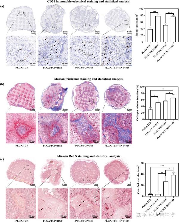 清华大学利用SUNPBP11低温沉积3D打印构建促血管化骨再生的多机制药物控释支架体系 - 知乎