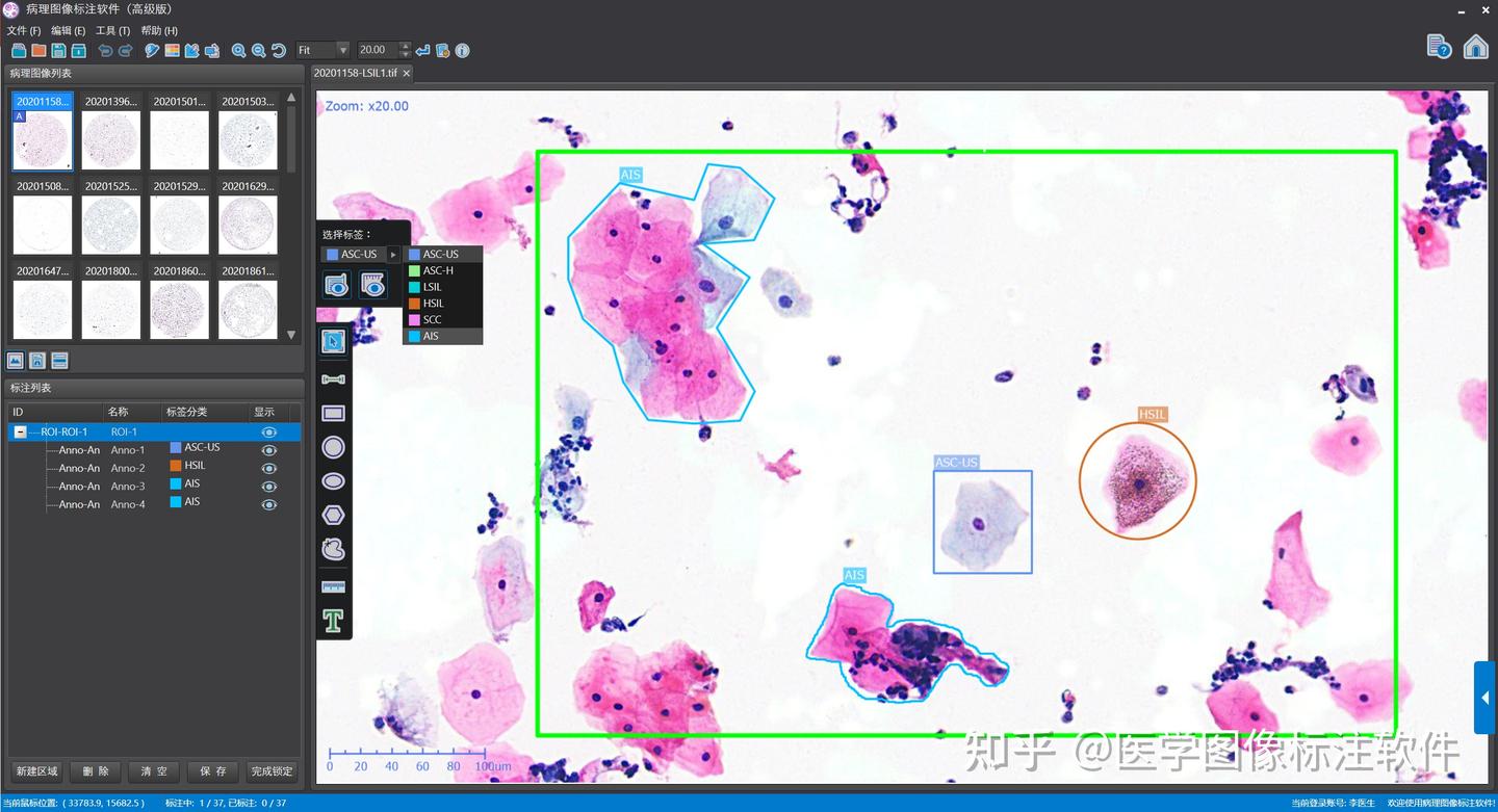 助力医学临床AI — MISAT医学图像分割与标注软件套装 - 知乎