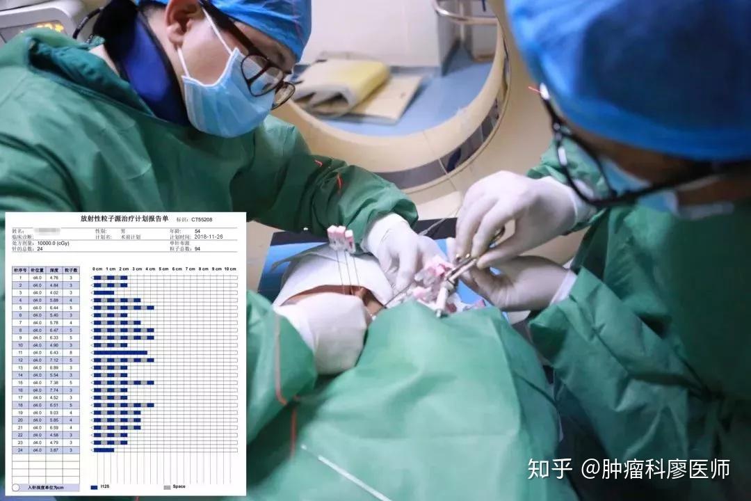 肿瘤热疗联合粒子植入让癌细胞缴械投降！ 知乎 8844