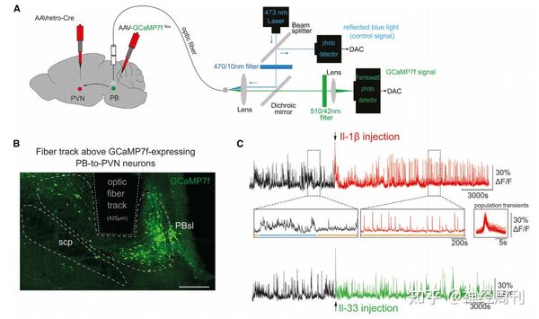 外周炎症，大脑及时响应！科学家揭示调控伤害性全身炎症反应的神经环路 - 知乎