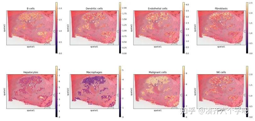 空间单细胞转录组cell2location分析流程学习 - 知乎