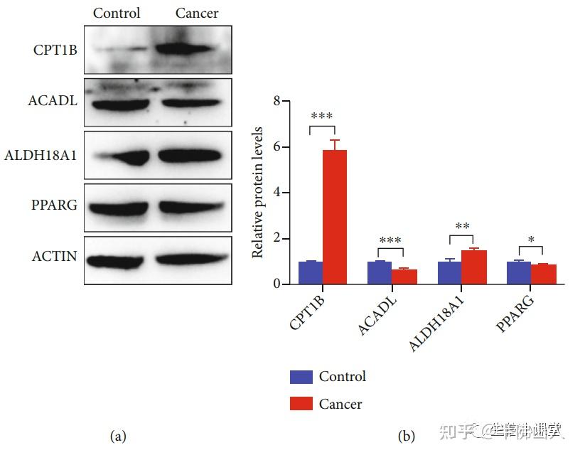 最新6.5分 基因集单肿瘤分析+WB表达验证 - 知乎