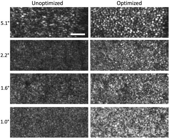 Biomed Opt Express：无波前传感器自适应光学相干断层成像（WSAO-OCT）在人视锥细胞镶嵌体活体成像中的应用 - 知乎