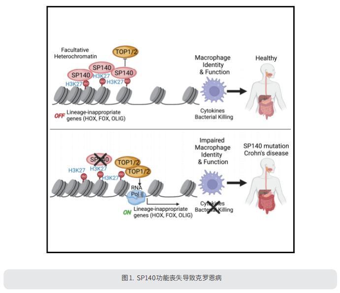 克罗恩病机制研究新发现 知乎