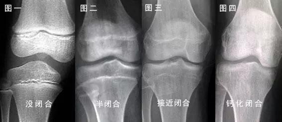 成年人经常拉伸,还可以长高吗? 知乎