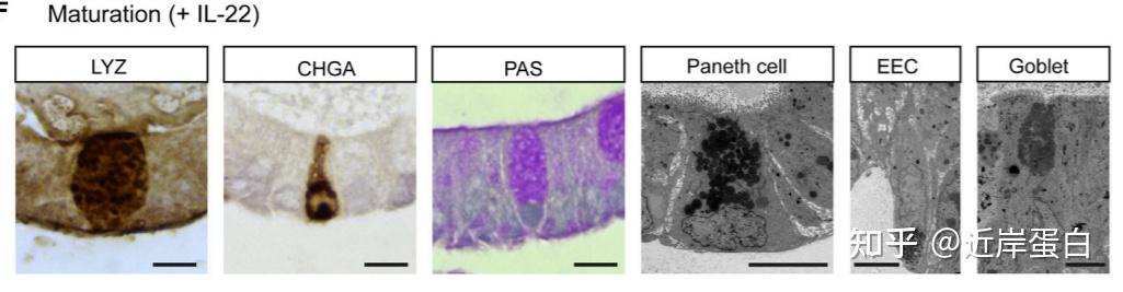Hans Clevers团队揭示，为什么IL-22有助于人肠道类器官模型建立 - 知乎