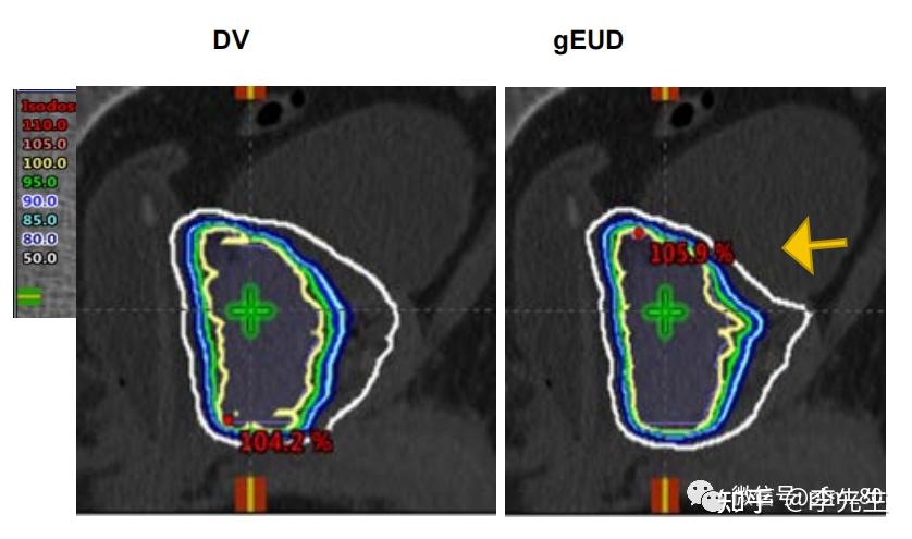 学习gEUD，用好gEUD（第二篇）。 - 知乎