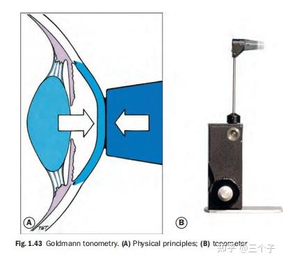 No.21, Tonometry(1),Goldmann tonometry - 知乎