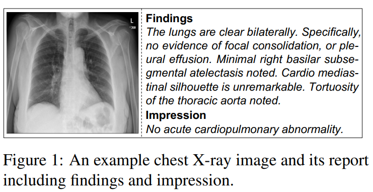 IU-Xray 印度大学胸部X线报告数据集介绍 - 知乎